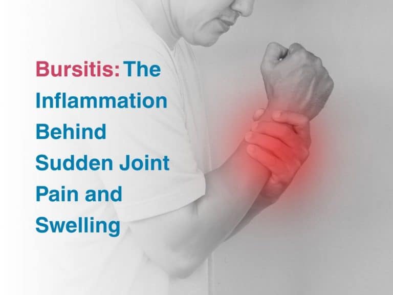 Bursitis: The Inflammation Behind Sudden Joint Pain and Swelling